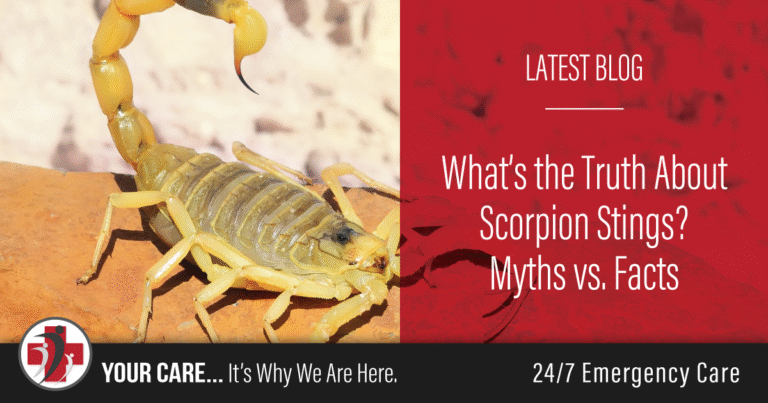 What’s the Truth About Scorpion Stings? Myths vs. Facts - Fountain ...